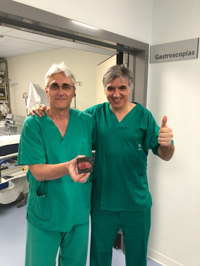 ESD LST-G rectal 65 x 45 mm (Baza HOSPITAL) (Dr. Guilarte and Dr ...