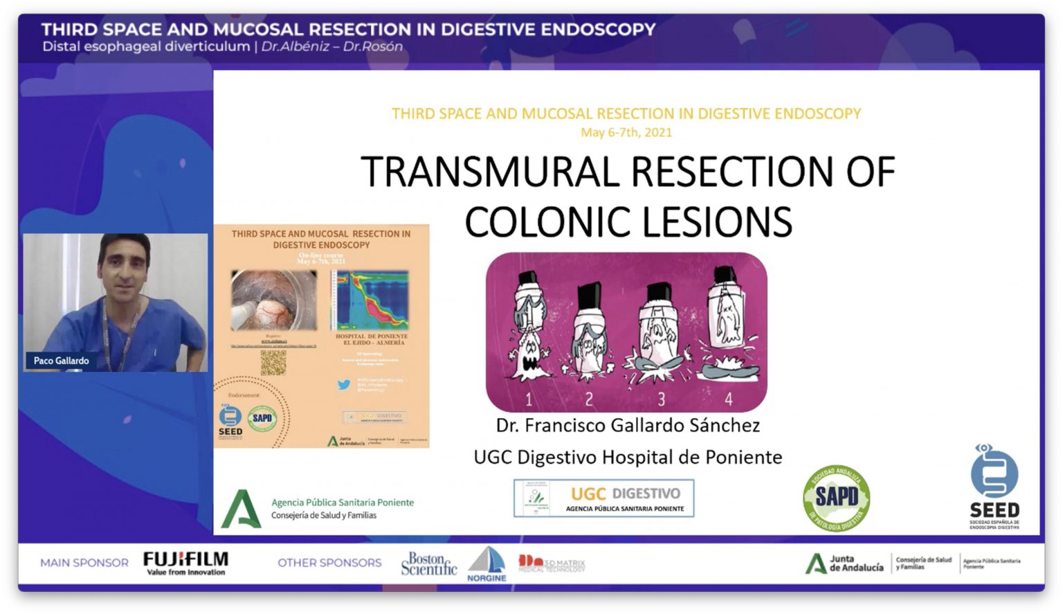 Full thickness resection (FTRD) in colonic lesions (F. Gallardo ...