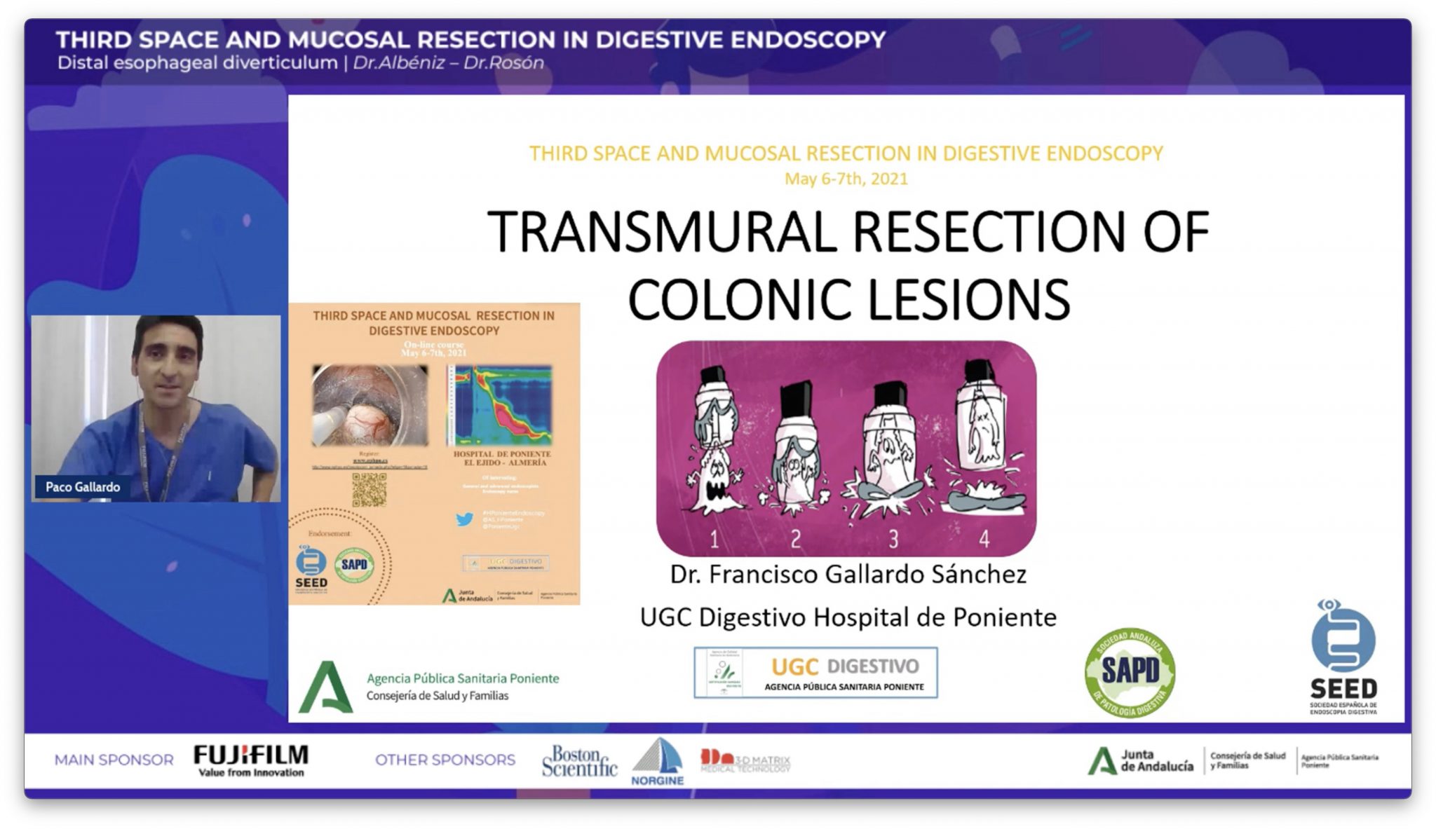 Full thickness resection (FTRD) in colonic lesions (F. Gallardo ...