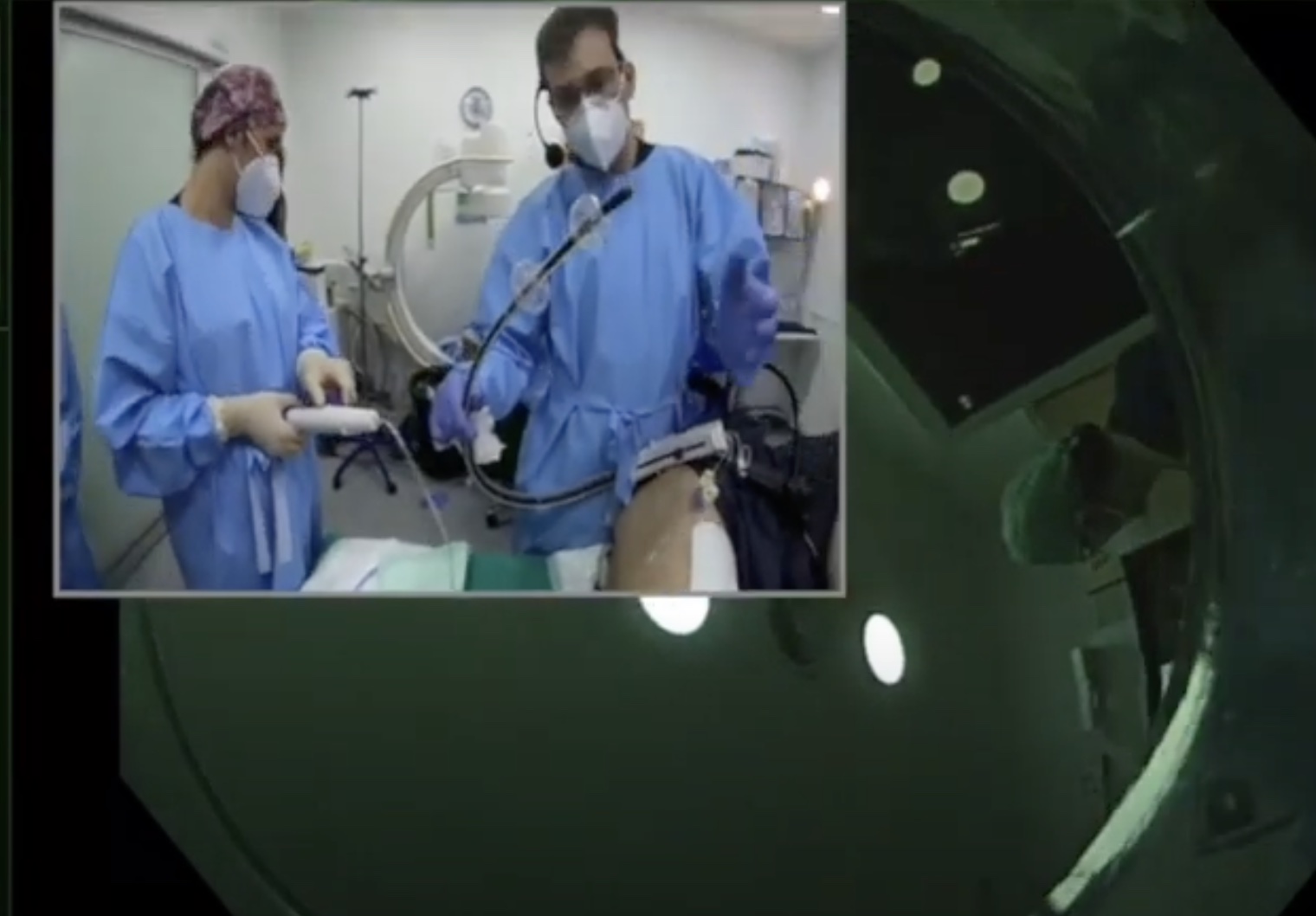 ESD of IIa + Is (LST-NG) 40 mm in descending colon with Dilumen EIP ...